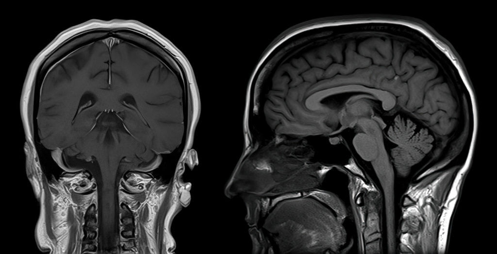 What Is MRI Imaging and How Does It Work? - Associates in Neurology
